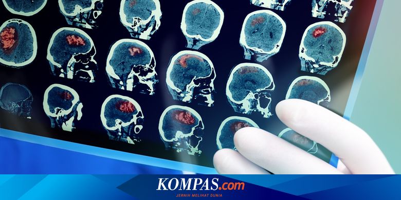 Tanda-tanda Kanker Otak Stadium Akhir yang Harus Diwaspadai