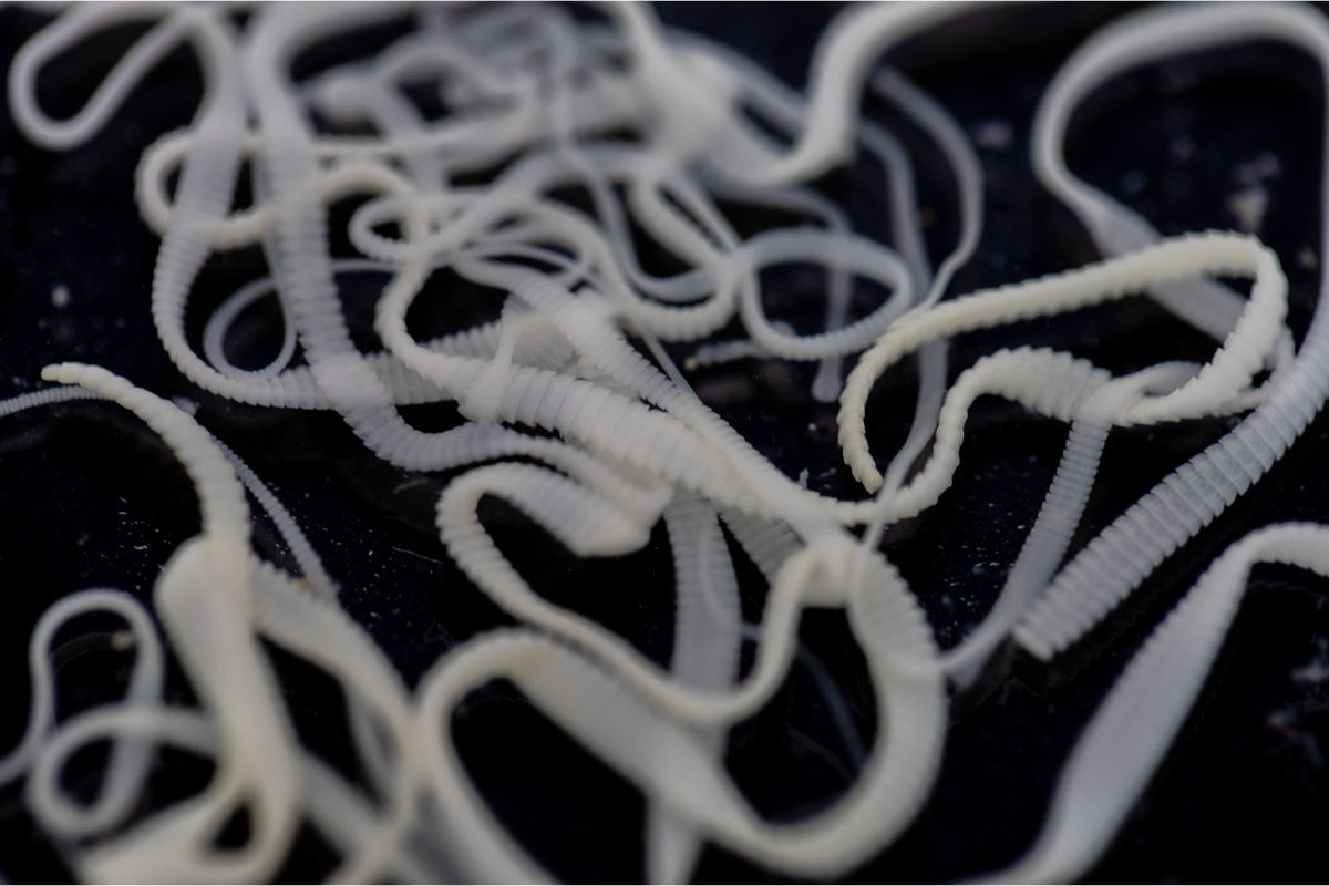 4 Cara Mencegah Cacingan pada Anak dan Dewasa Menurut Dokter