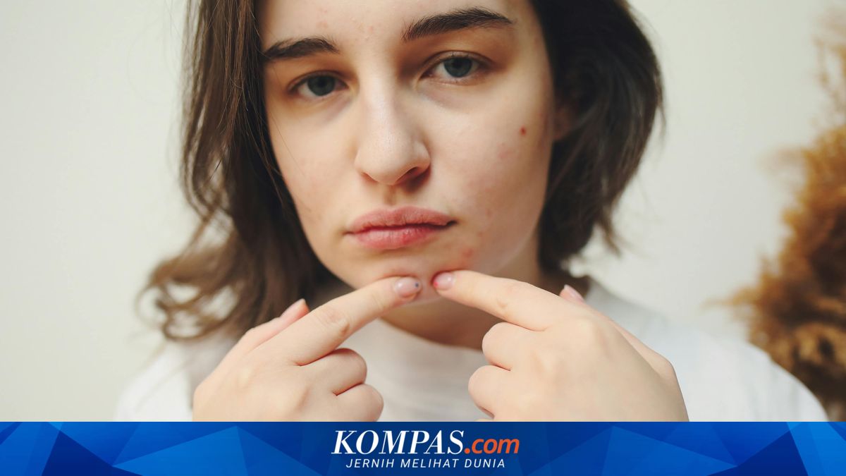 7 Urutan Skincare untuk Acne-Prone Skin Menurut Dokter Kulit