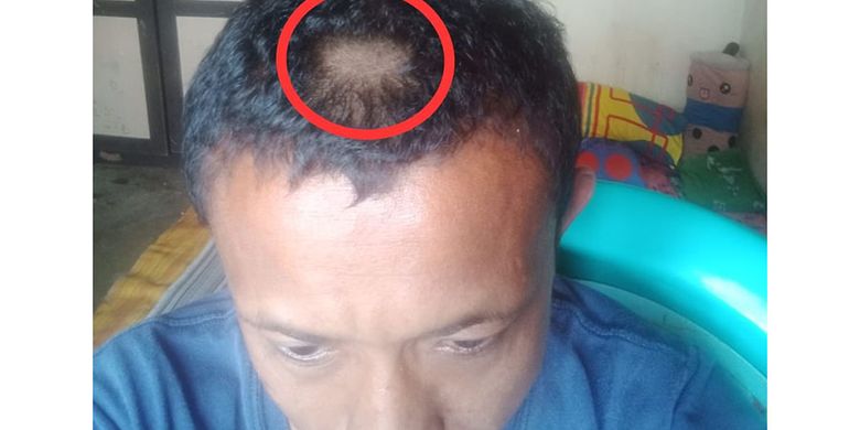 Berita Harian Gunting Rambut Terbaru Hari Ini - Kompas.com