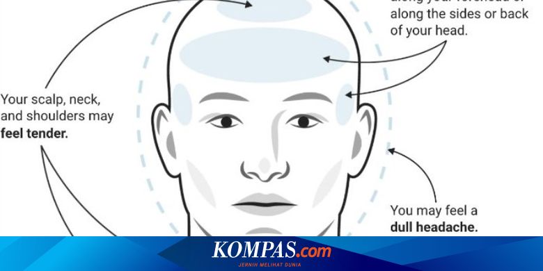 Penyakit Sakit Kepala Tegang - Gejala, Penyebab, Pengobatan - Kompas.com