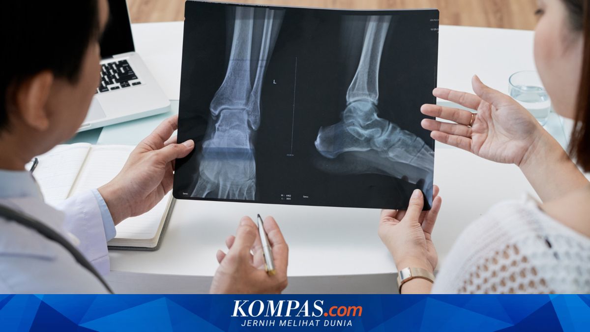 Kurang Kolagen Bisa Memicu Pengapuran Sendi di Usia Muda
