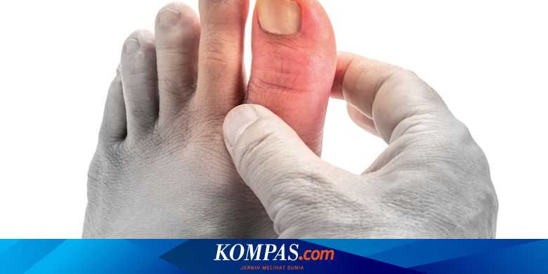 Minum Apa biar Asam Urat Turun? Berikut 5 Daftarnya