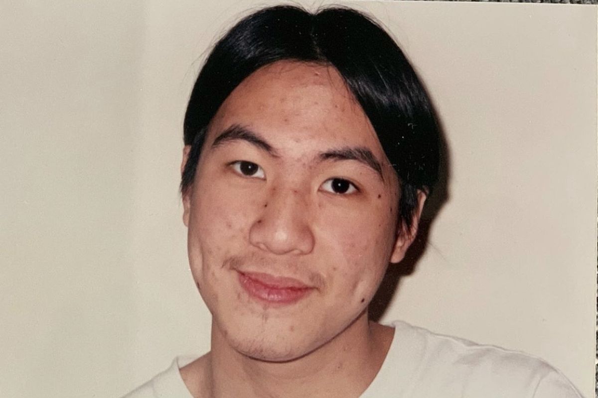 Until Tomorrow Challenge, Daniel Mananta Unggah Foto Saat Kena Cacar Air