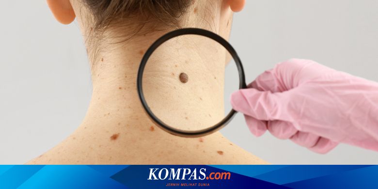 7 Kebiasaan Pemicu Kanker Kulit yang Harus Diwaspadai