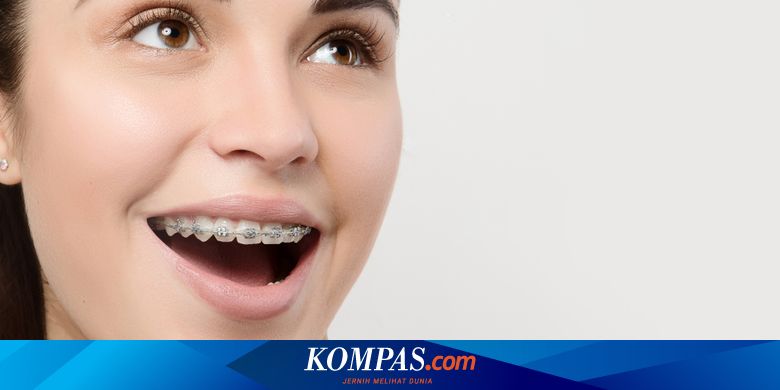 Pakai Behel Bukan Hanya untuk Gaya-gayaan, Begini Penjelasan Medisnya