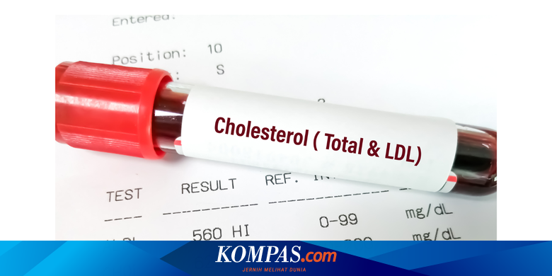 Kenali Cara Kerja Obat Kolesterol yang Umum Digunakan