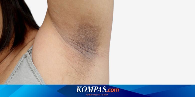 Ketiak Hitam Bisa Diputihkan Lagi, Begini Saran Dokter Kulit...