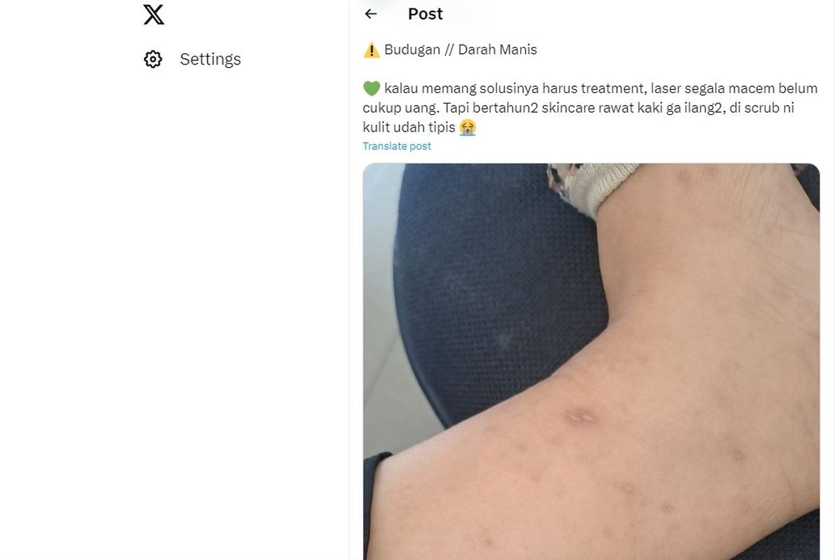 Ramai soal Kulit Bentol-bentol Disebut Penyakit Darah Manis, Ini Kata ...