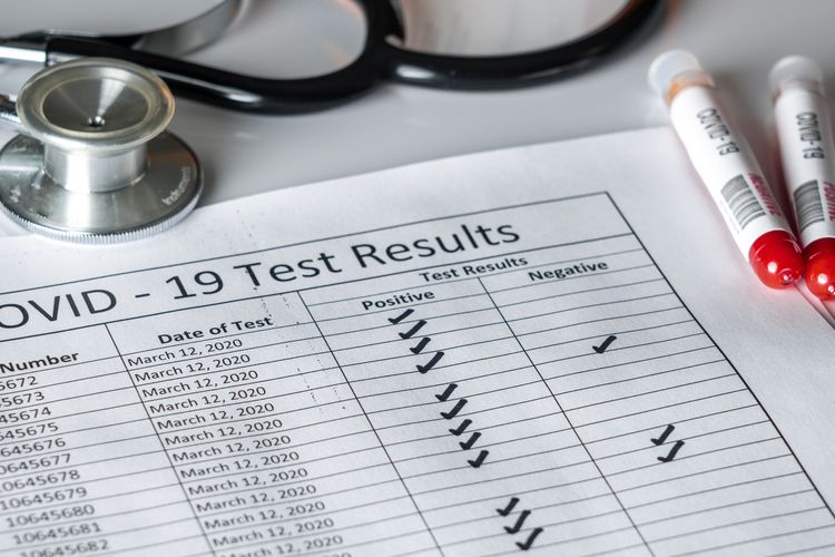 Faktor Berikut Dapat Memengaruhi Hasil Tes Covid-19, Apa Saja?