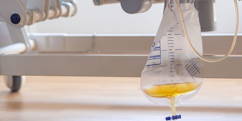 Ramai Soal Kateter Urine, Apa Itu, Fungsi dan Jenisnya