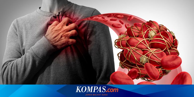 Gejala Penggumpalan Darah, Bisa Terjadi di Ginjal hingga Otak