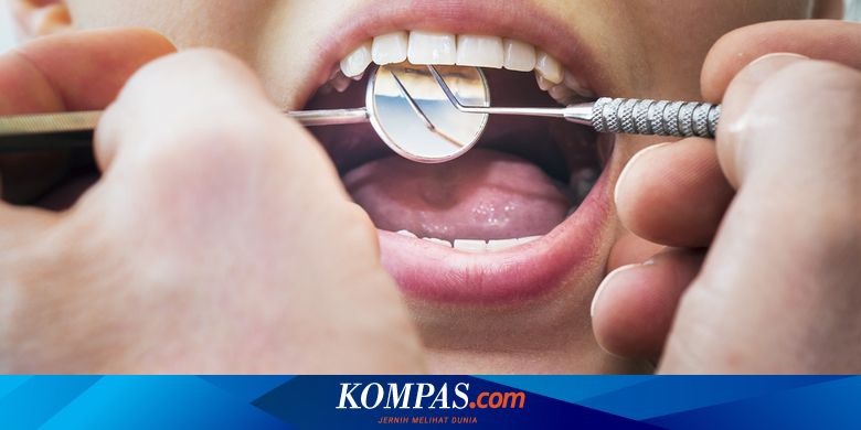 Apakah Tambal Gigi Ditanggung BPJS Kesehatan? Simak Prosedurnya