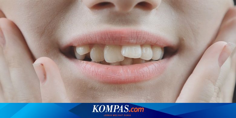 13 Penyebab Gigi Bengkok dan Cara Mengatasinya