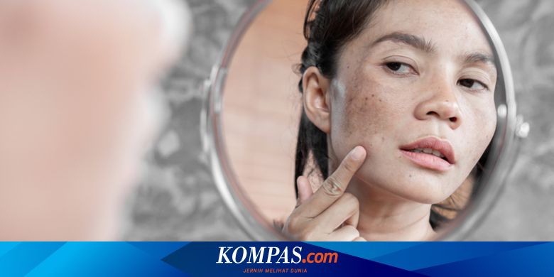 Flek Hitam Membandel? Kenali Jenis dan Penyebabnya