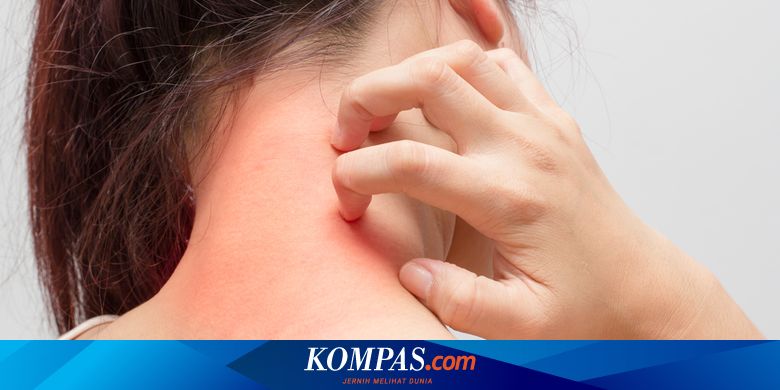 11 Cara Mudah Mengatasi Leher Gatal