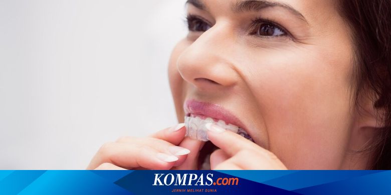 Agar Bentuk Gigi Tetap Rapi Setelah Kawat Gigi Dilepas