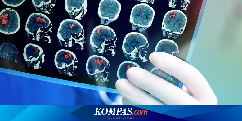 Bagaimana Tingkat Kelangsungan Hidup Penderita Kanker Otak?