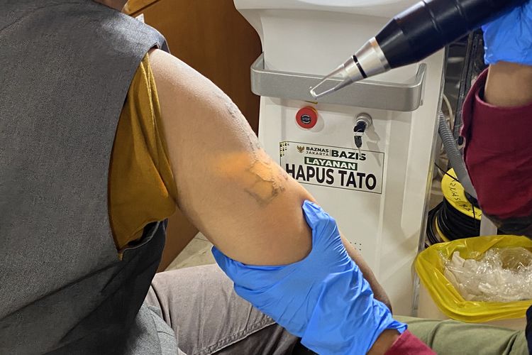 Berita Terkini Harian Hapus Tato Gratis Di Jakarta Terbaru Hari Ini ...