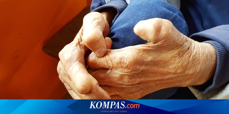 Mengenal Penyakit Kusta dari Ciri-ciri hingga Masa Inkubasinya