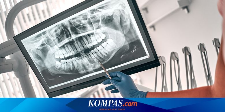 Mengenal “CT-Scan” Gigi sebagai Alat Bantu Diagnosis