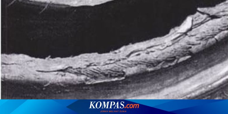 Pelajari Penyebab Bead Burn pada Ban Truk