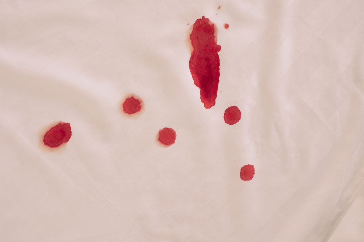 Cara Menghilangkan Noda Darah dari Seprai dan Kasur