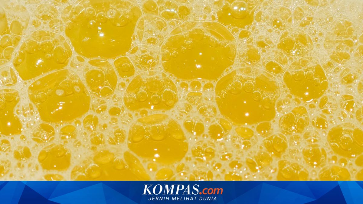 Urine Berbau seperti Feses, Dokter Jelaskan Penyebab dan Bahayanya