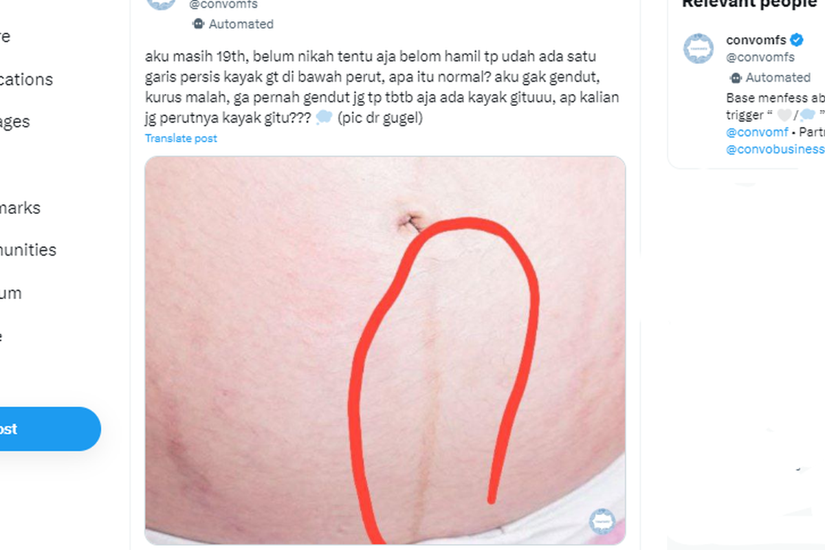 Muncul Garis Vertikal Hitam di Perut meski Tidak Sedang Hamil, Apa ...