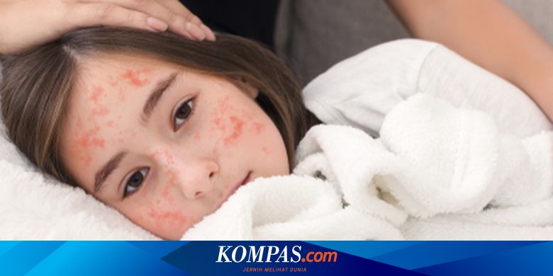 Mengenal Apa Itu Penyakit Campak dan Komplikasinya...