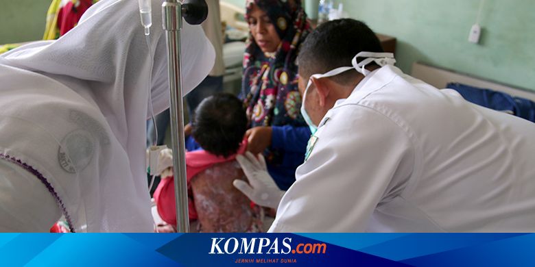 Bawaan Lahir, Radang Kulit yang Diderita 2 Bocah di Bireuen Sulit ...
