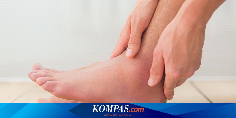 Penyebab Varises di Kaki dan 6 Faktor Risikonya