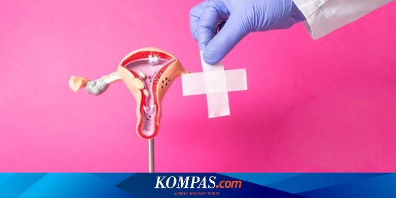 7 Jenis Miom pada Wanita, Mana yang Paling Berbahaya?