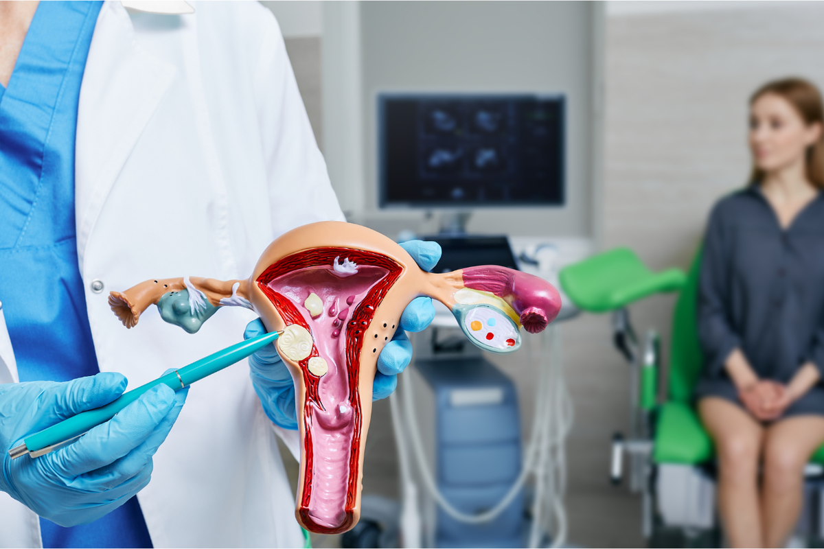 Dokter Ungkap Gejala Kista di Rahim yang Perlu Diwaspadai, Apa Saja?