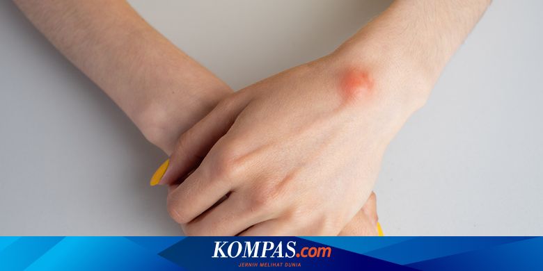 9 Penyebab Kista yang Perlu Diwaspadai
