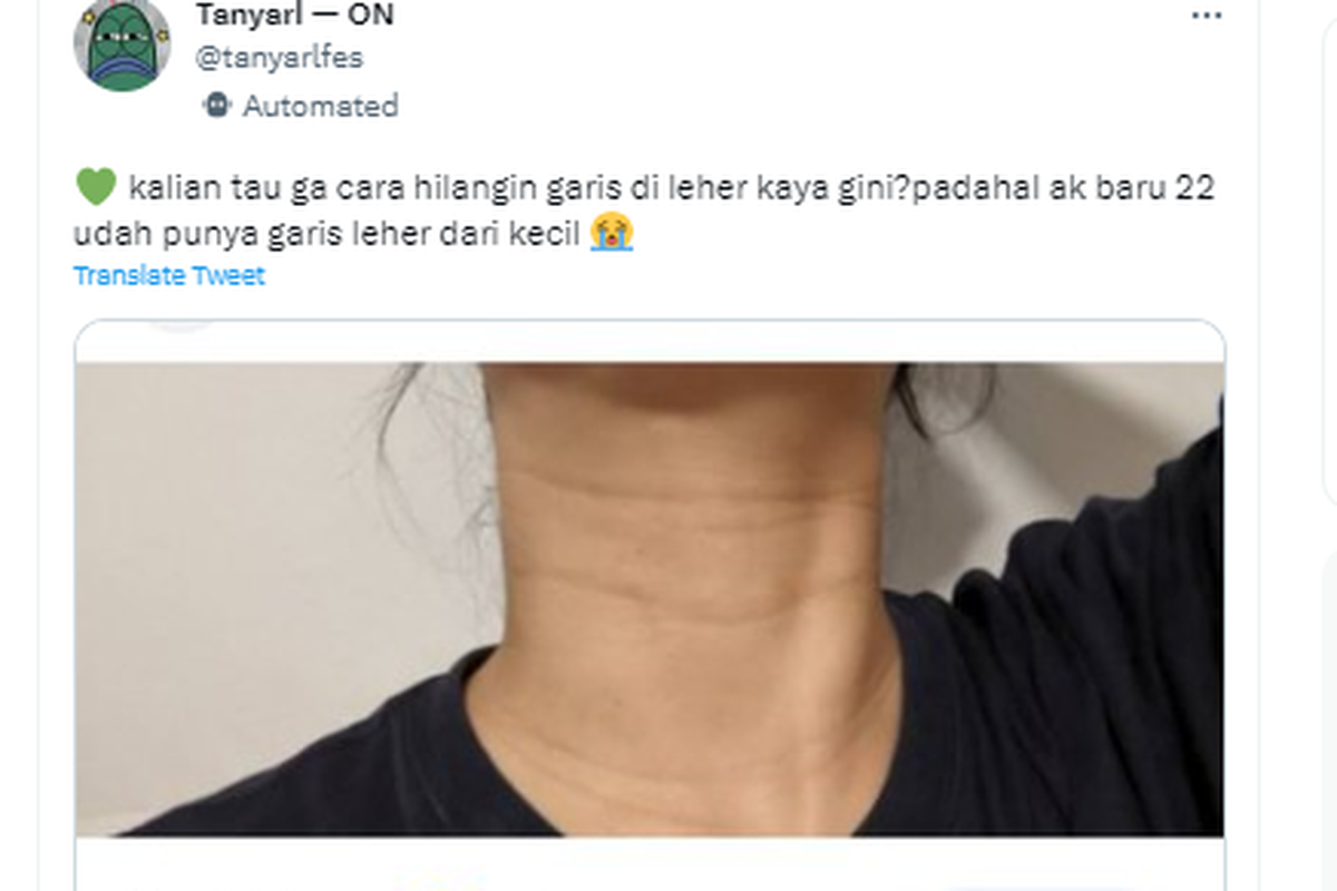 Ada Garis-garis di Leher, Apa Penyebab dan Bagaimana Cara Mengatasinya?