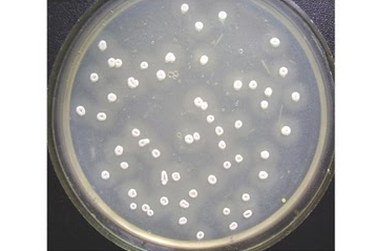 Tetrasiklin, Antibiotik yang Dihasilkan Streptomyces aureofaciens