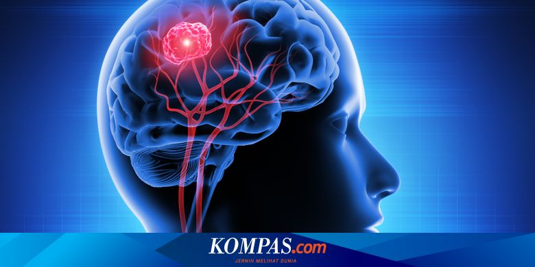 8 Faktor Risiko Tumor Otak yang Perlu Anda Ketahui