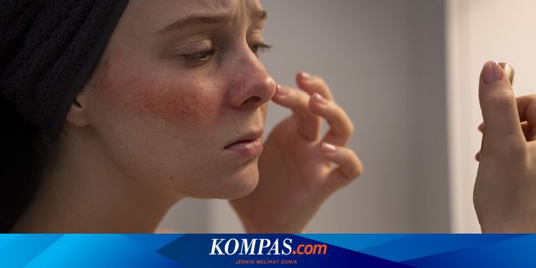 Berapa Lama Kulit Belang Kembali Normal? Berikut Penjelasannya…