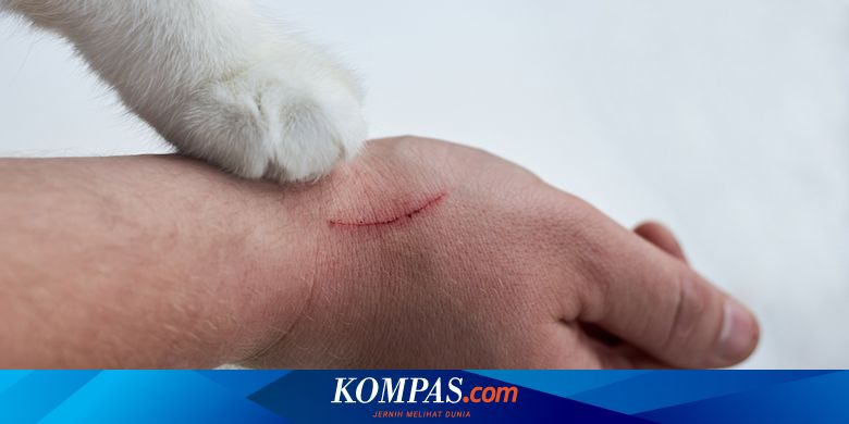 Penyakit Cat Scratch Disease - Gejala, Penyebab, Pengobatan - Kompas.com