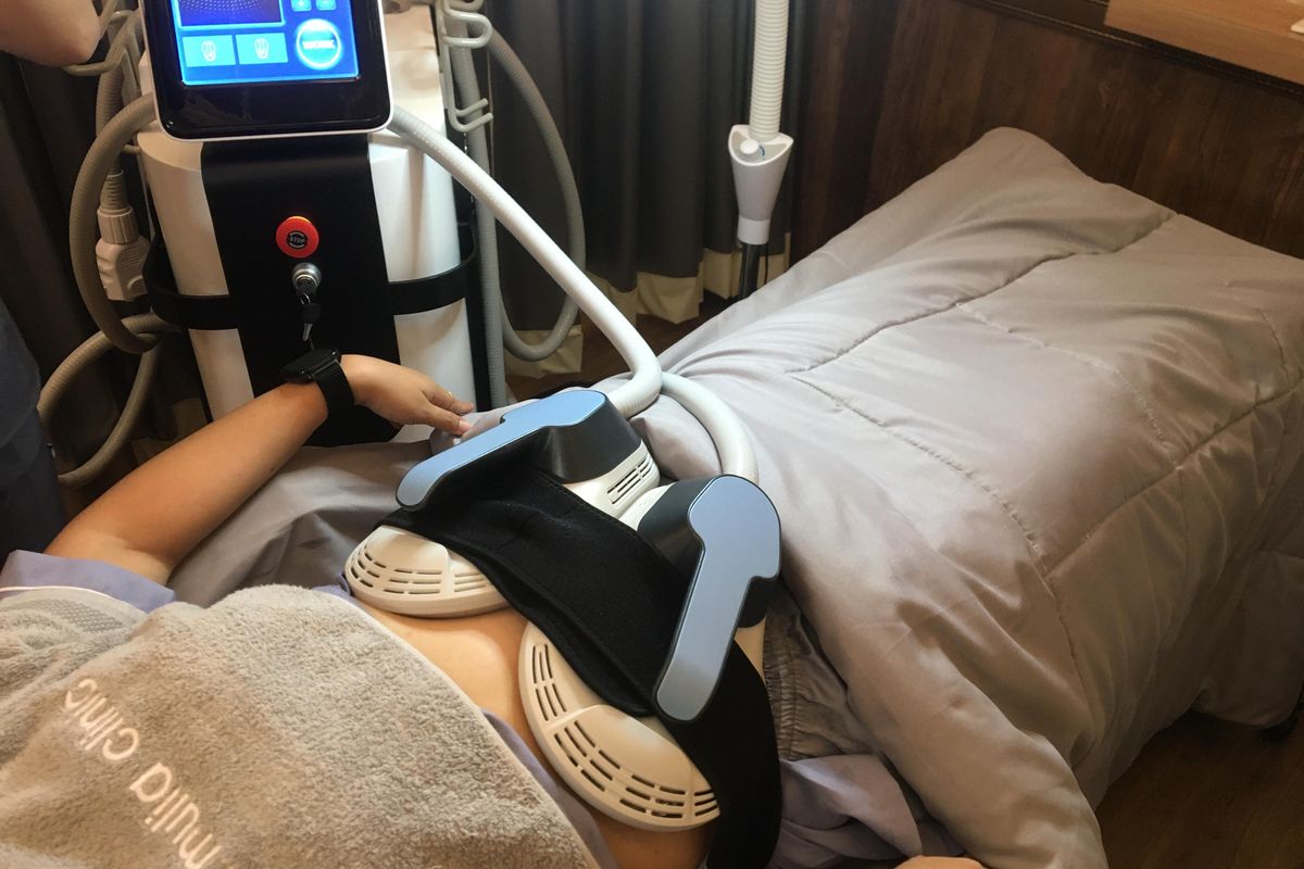 Cryo Slimming Pro, Treatment untuk Mengecilkan Lingkar Perut Tanpa Operasi