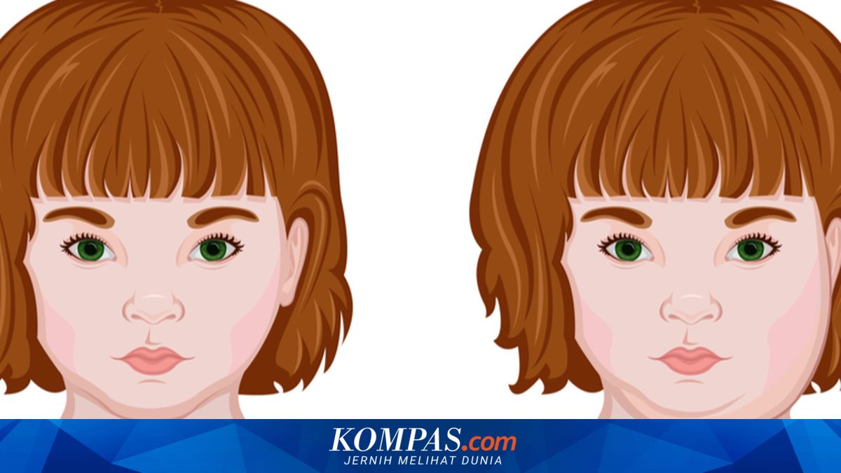 Penyakit Parotitis - Gejala, Penyebab, Pengobatan - Kompas.com