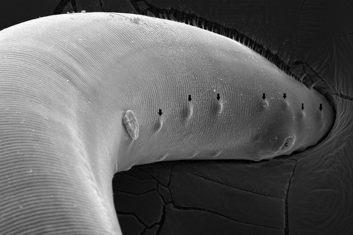 Dokter Temukan 4 Cacing Hidup di Bawah Kelopak Mata Seorang Wanita di China