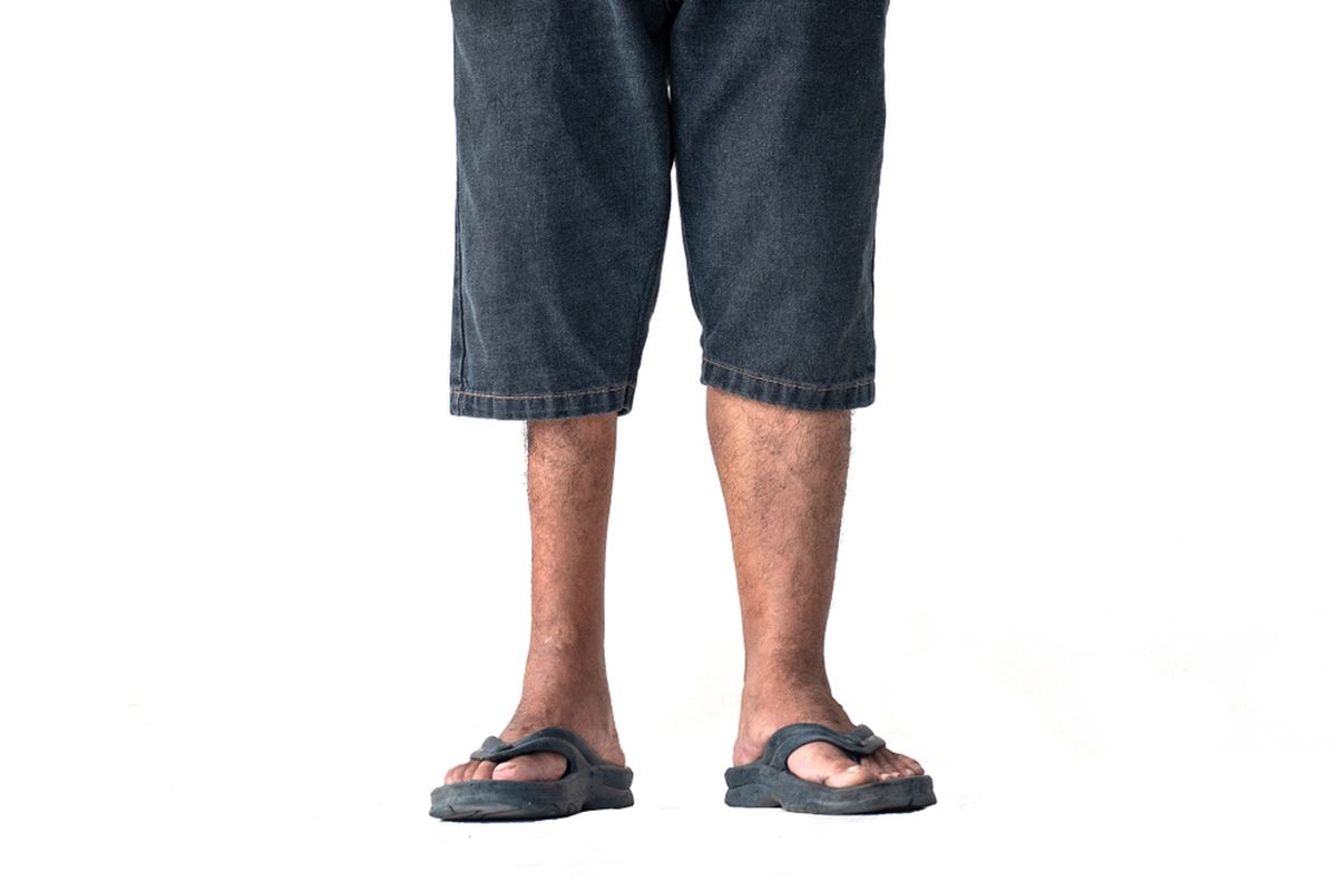 Atrofi Otot: Penyebab, Gejala, dan Perawatannya