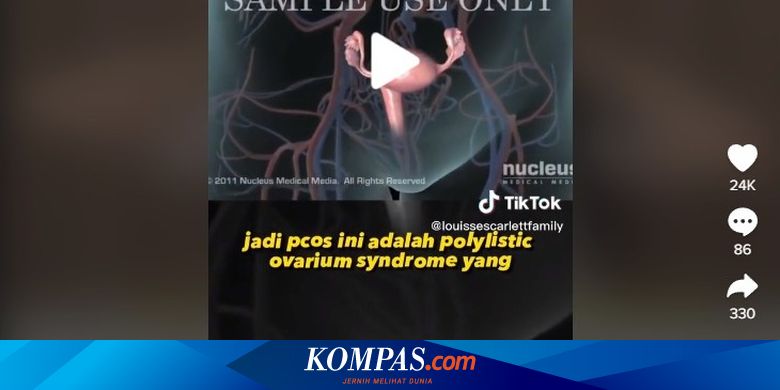 Berita Terkini Harian Ciri Ciri Pcos Pada Remaja Terbaru Hari Ini ...