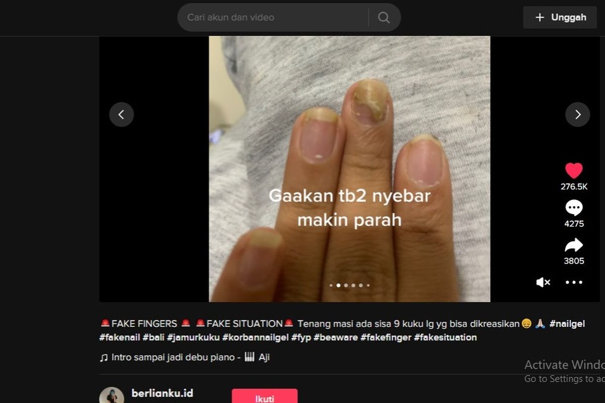 Ramai Infeksi Jamur Kuku Bikin Kuku Rusak dan Lepas, Benarkah Bisa Disebabkan Nail Arts? Ini ...