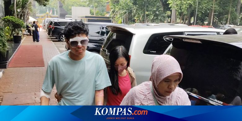 Agus Salim Korban Penyiraman Air Keras Sudah Tak Bersedih Lagi