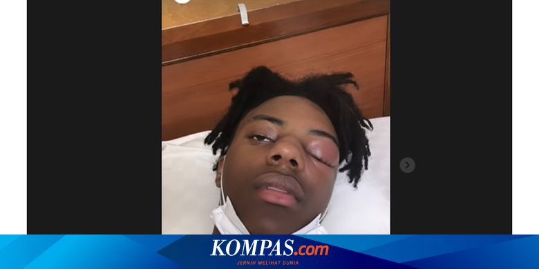 YouTuber iShowSpeed Alami Cluster Headache, Apa Itu?