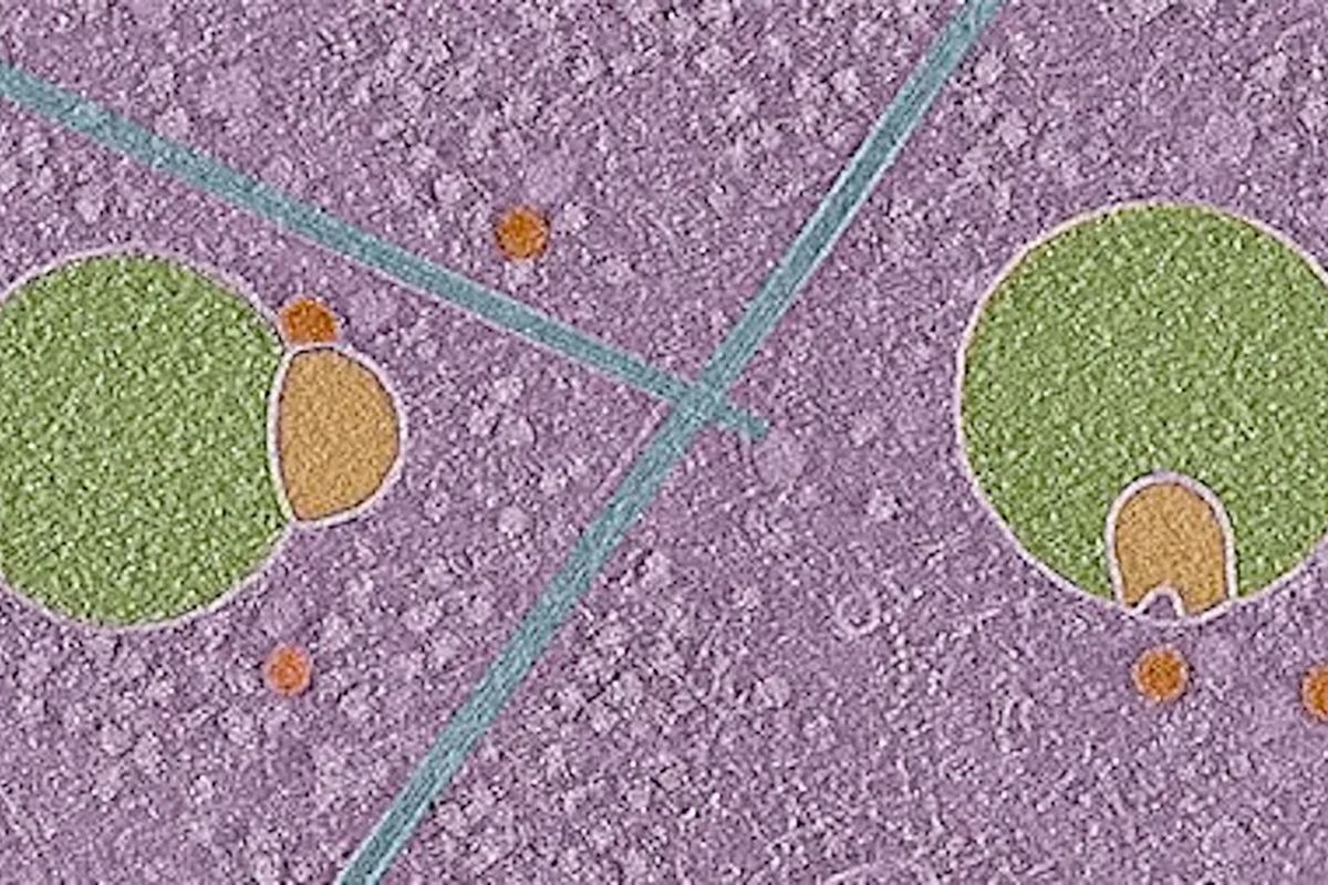 Ilmuwan Temukan Bagian Sel Manusia yang Belum Pernah Terlihat