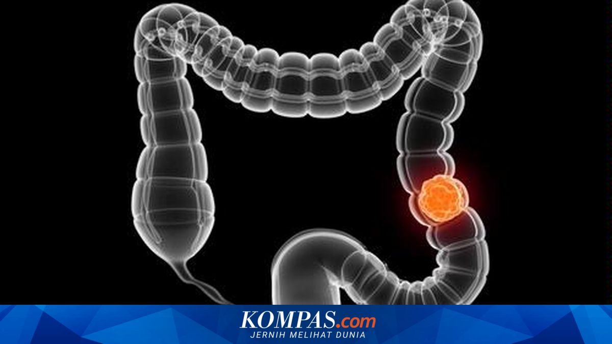 Panduan Miliki Usus Sehat